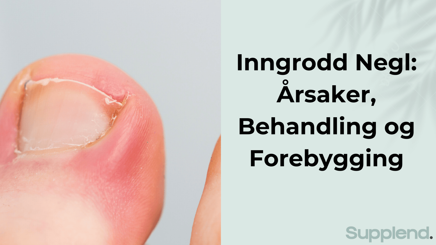 Neglesykdommer: Symptomer, Psoriasis og Neglesopp | Supplend